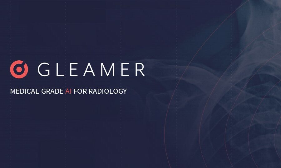 Archives des Interviews video - La Synapse